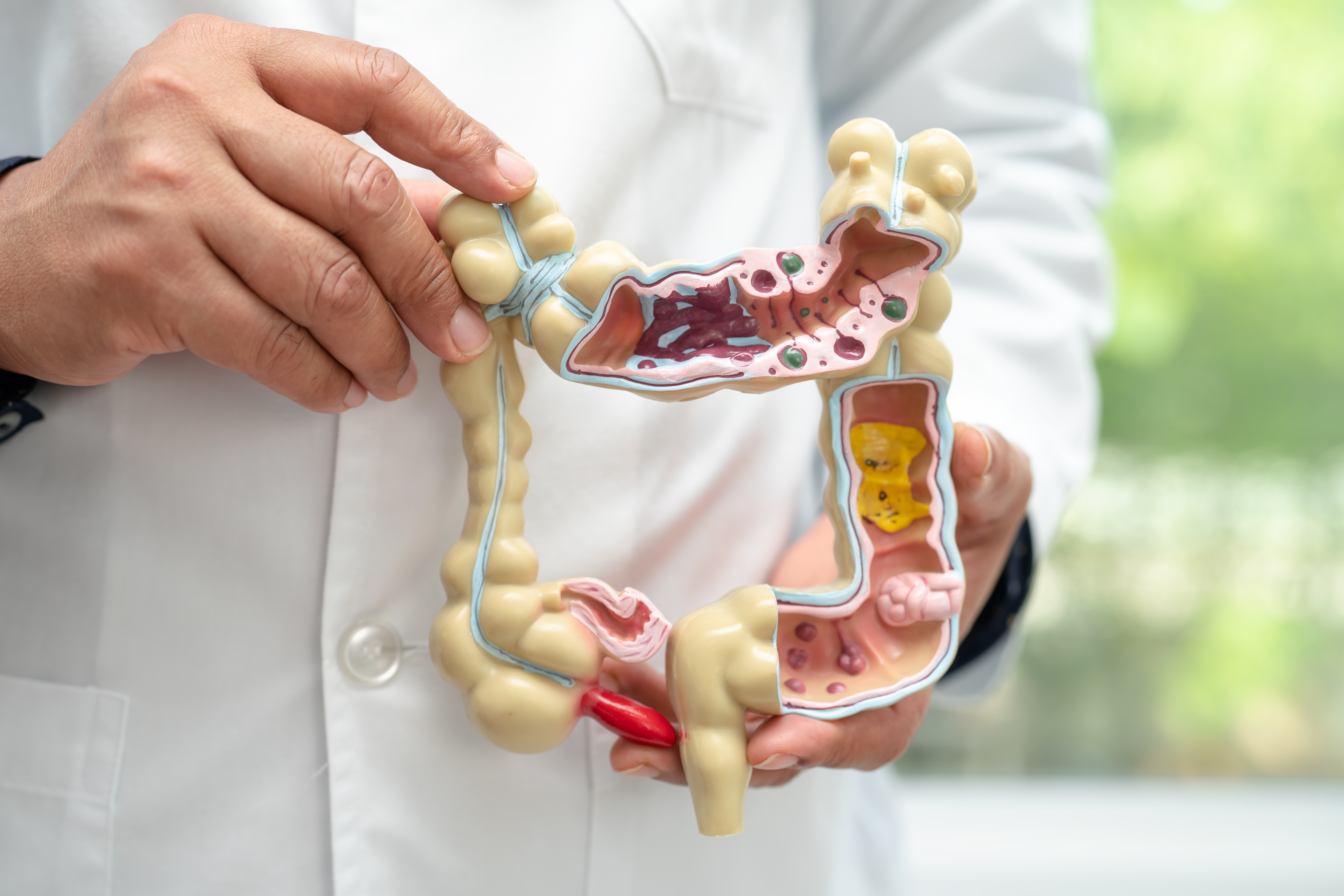 Coloproctologista em Presidente Prudente - luzMed Blog
